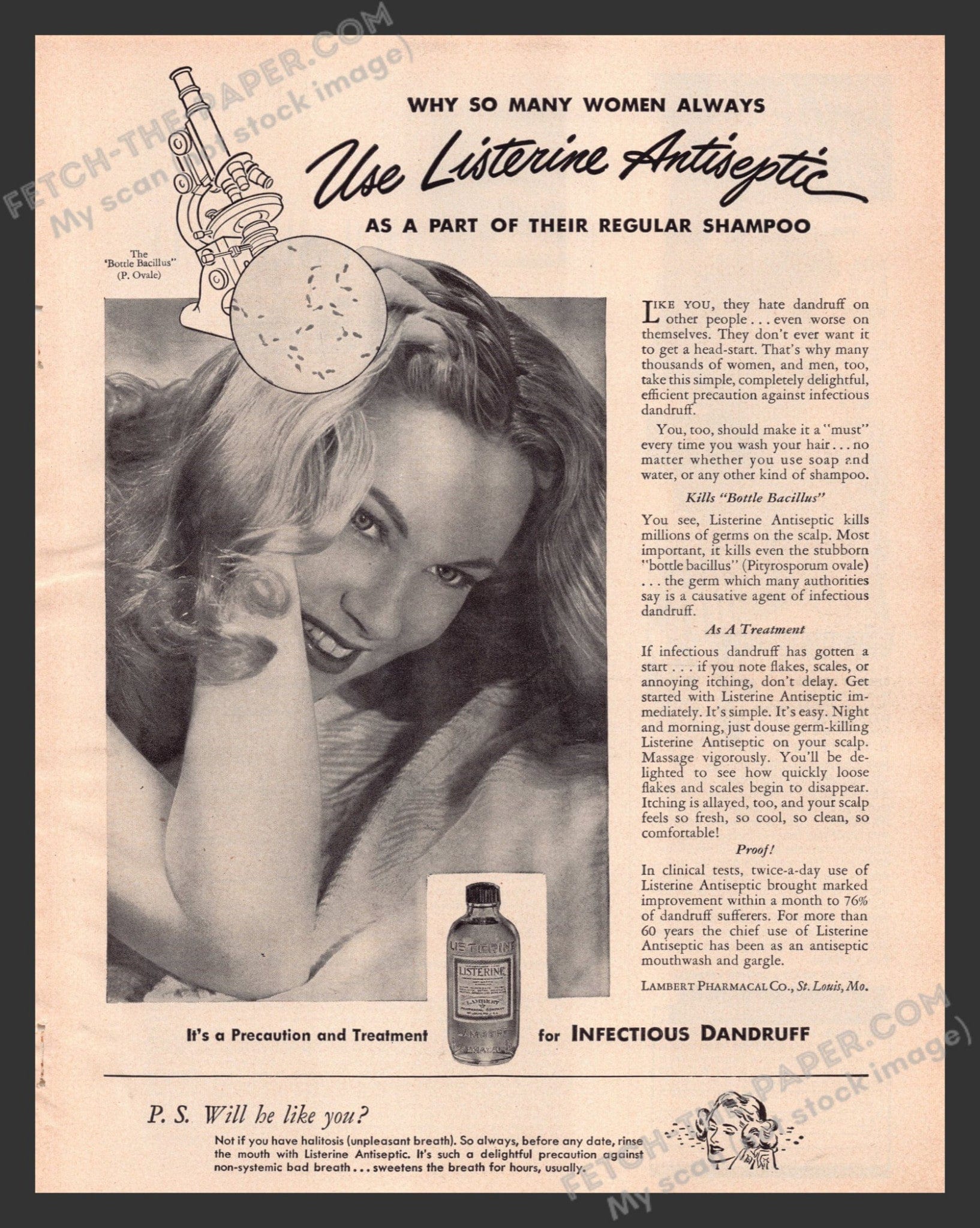 dandruff advertisement